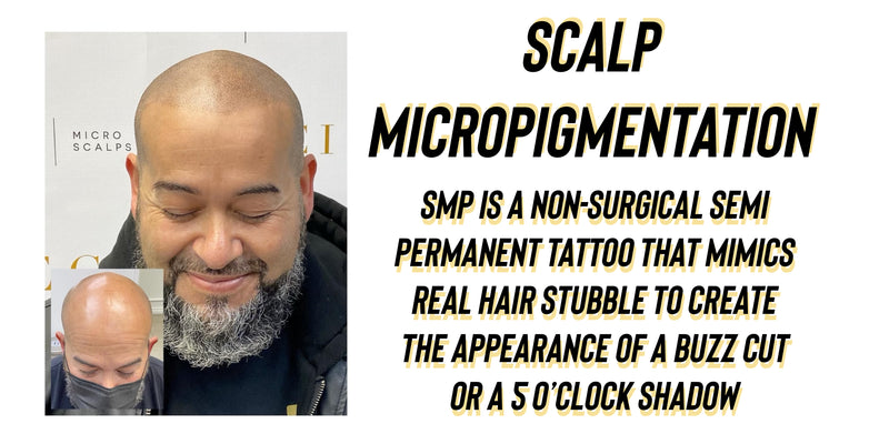 #1 Scalp Micropigmentation Clinic in Rancho Cucamonga, California ...